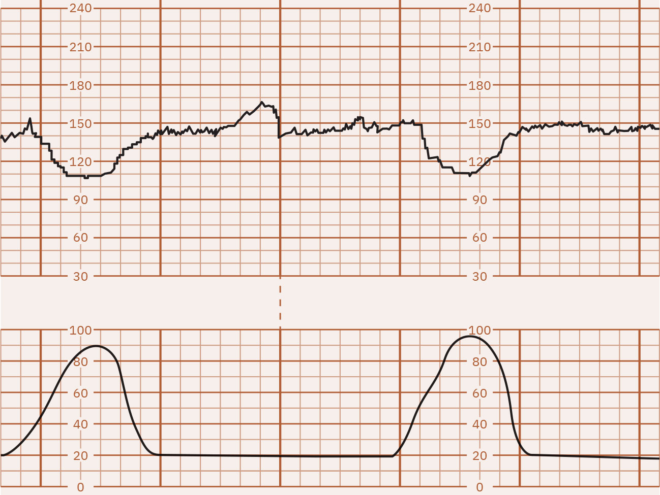 10 5 Fetal Heart Rate Monitoring Nursing Health Promotion